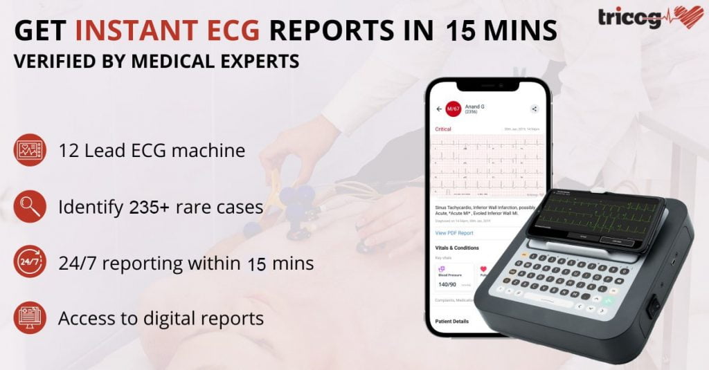 VCardia ECG Machine by Tricog