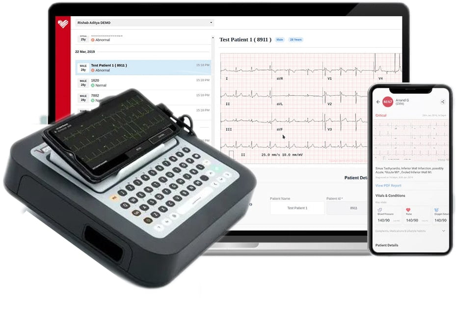 VCardia ECG Machine by Tricog